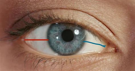 Hello If You Know Eye Anatomy Well Could You Tell Me Why Area Where I