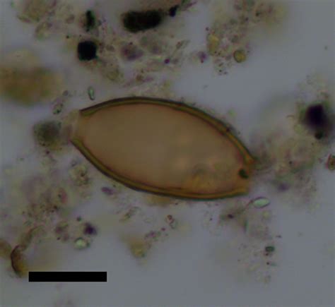 What Do Tapeworms In Human Stool Look Like