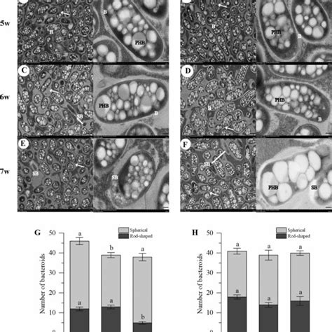 Paraffin Section Observation Of Nodule Structure During Soybean Nodule Download Scientific