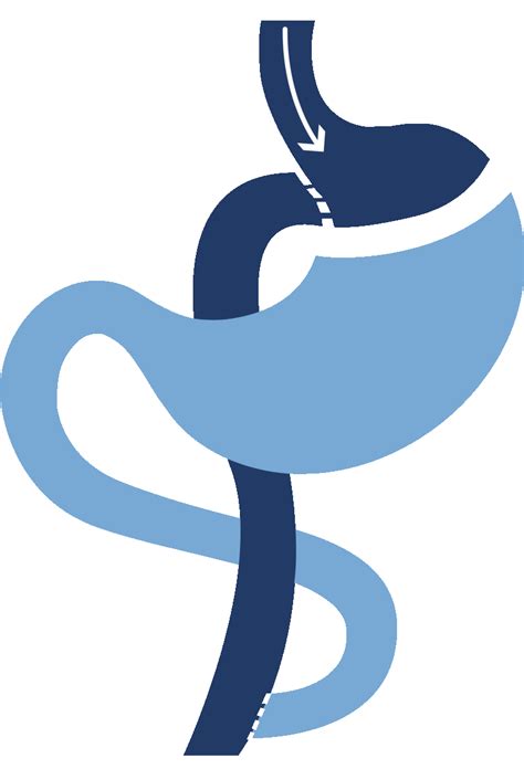 Gastric Bypass Surgery Halcyon Hospital