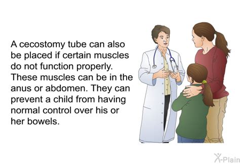 PatEdu Com Cecostomy