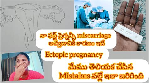 Ectopic Pregnancyకొంచెం లేట్ ఐతే ప్రాణాలకే ప్రమాదం అని చెప్పారు Youtube