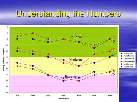 Audiometric Testingppt