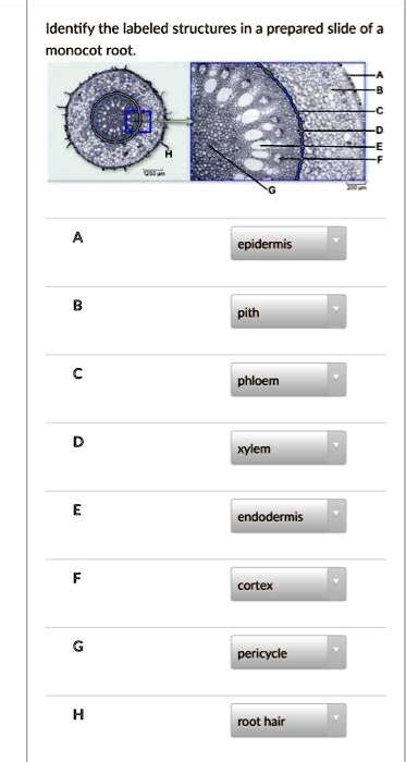 Identify The Labeled Structures In A Prepared Slide Of A Monocot Root Epidermis Pith Phloem