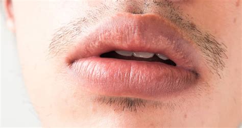 疱疹嘴唇年轻的男人男人涂片疱疹疱疹奶油图片 包图网企业站