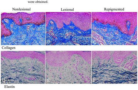 Azan Staining Reveals Well Developed Collagen Fibers Stained Light Download Scientific Diagram