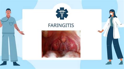 Faringitis Cronica Pptx