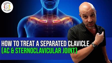 Sternoclavicular Joint Sprain