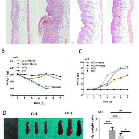 Topical Ozone Treatment Significantly Inhibits Imq Induced