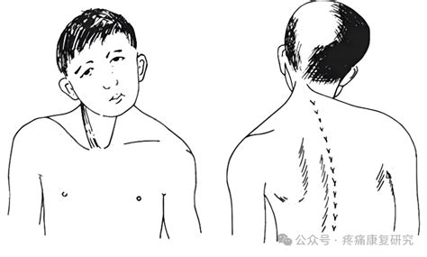 骨化性肌炎的病因病理检查及诊疗 MedSci cn