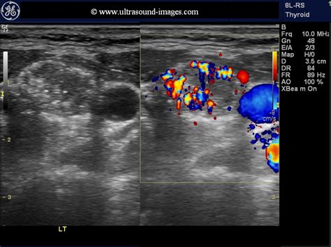 A Gallery Of High Resolution Ultrasound Color Doppler And 3d Images