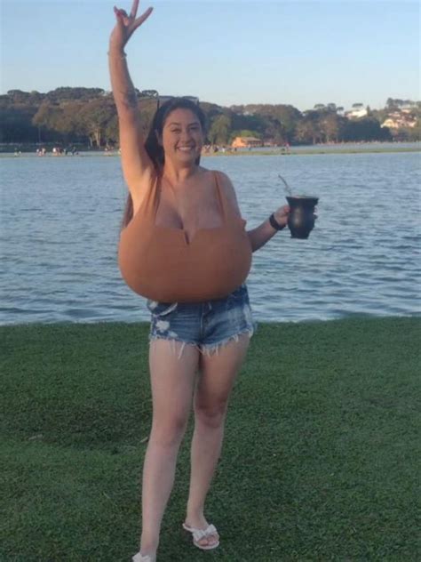 Brazilian Woman One Of 300 Women Diagnosed With Breast Issue The Advertiser