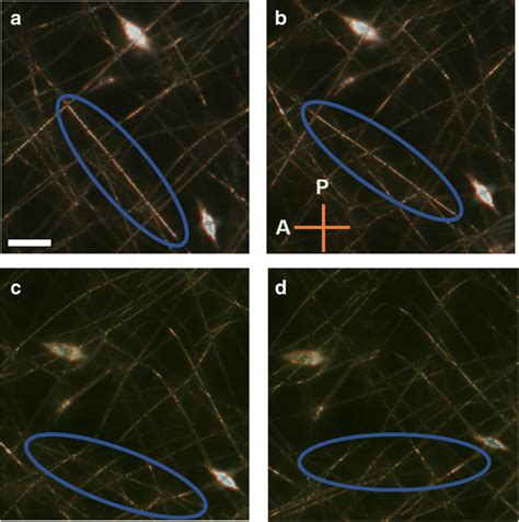 Optical Textures Of M3 Sample Taken Between Crossed Polarizer And Download Scientific Diagram