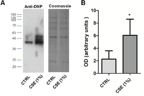 Protein Carbonylation Levels In Evs Released By Control And Cse Treated
