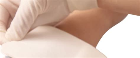 Top Hydrocolloid Dressing Examples Trusted By Wound Care Specialists