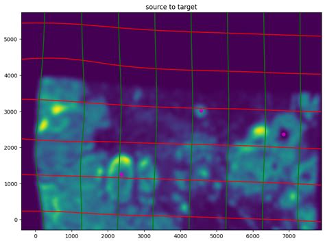 Aligning Partially Matched Serial Single Cell Resolution Breast Cancer Spatial Transcriptomics