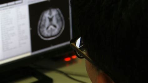 어려운 의약용어 순화한다면서자기공명·컴퓨터단층 무슨 말 Sbs Biz