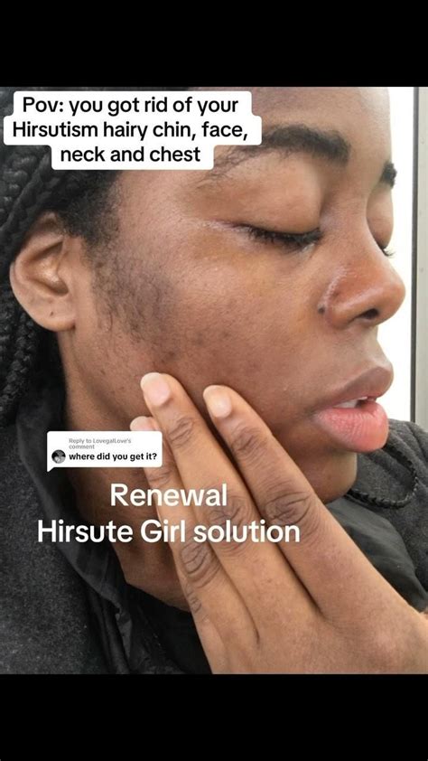 Best 12 Why Do Women Get Chin Hair Artofit