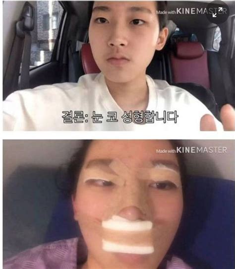 눈 코 성형한 여고생‥ 코 유머 감각 유머
