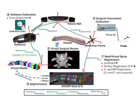 Ar Based Surgical Navigation