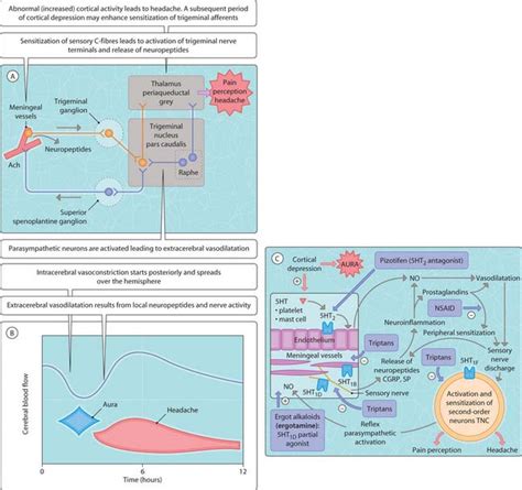 Migraine Basicmedical Key