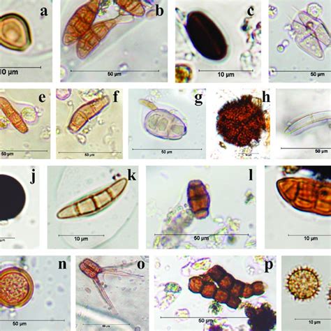 Fungal Spore Types Found During Sampling University Of Antioquia