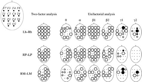Diagrams Showing Differences Between EEG Spectral Characteristics Download Scientific Diagram