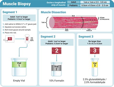 What Are Biopsy Specimen At Dara Patao Blog