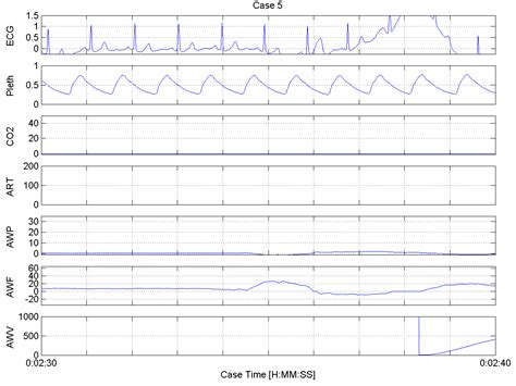 Case 5 Waveform Plots 10 Second Plots