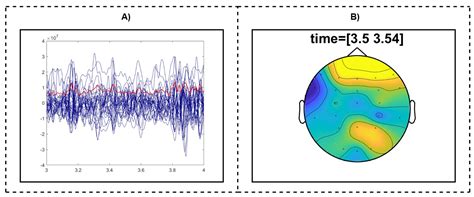 Integrating Electroencephalography Source Localization And Residual Convolutional Neural Network
