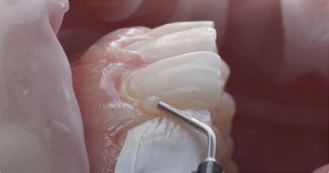 Tips And Tricks By Dr Micha Jaczewski