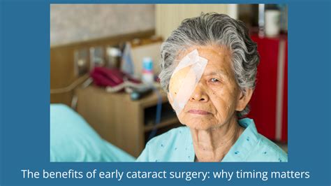 Benefits Of Early Cataract Surgery Why Timing Matters