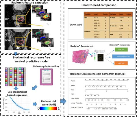 Ai Tool For Mri Could Transform Prostate Cancer Surgery Treatment