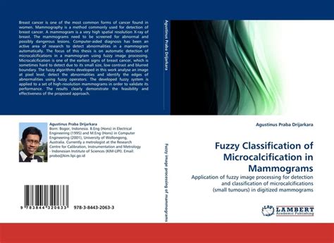 Fuzzy Classification Of Microcalcification In Mammograms Drijarkara