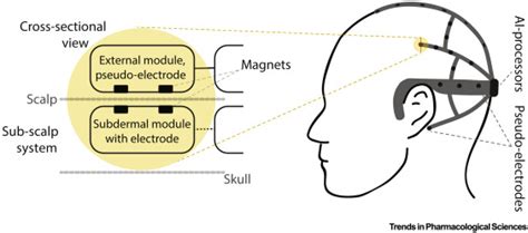Opportunities For Electroceuticals In Epilepsy Trends In Pharmacological Sciences