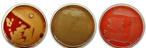 Streptococcus Spp Flashcards Quizlet