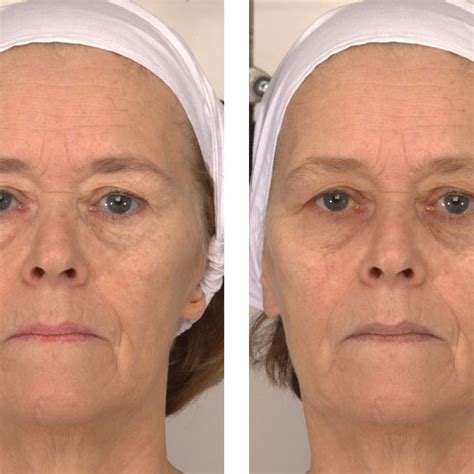 Contrast Manipulated Versions Of A Face The Left Image Shows One Of Download Scientific