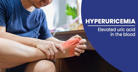 What Is Hyperuricemia Faqs