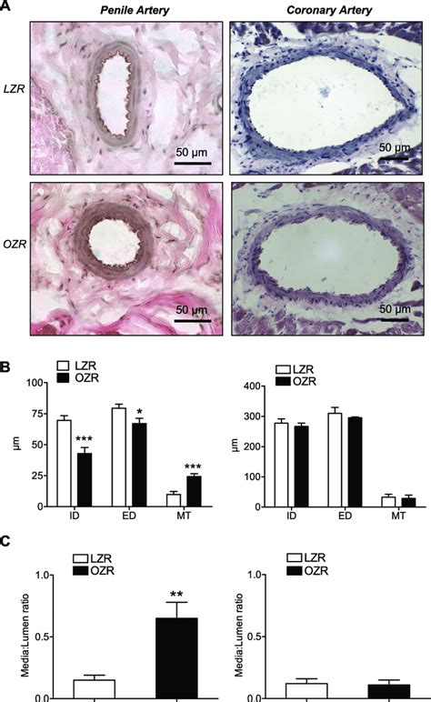 There Was A Fourfold Increase In The Media To Lumen Ratio In Penile Download Scientific Diagram