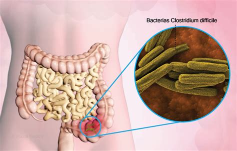 Health Condition Symptoms Causes Treatment And More