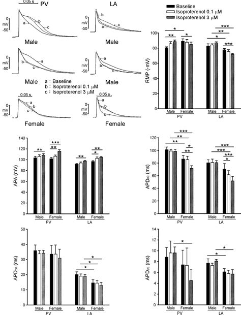 Sex Differences In The Electrophysiological Characteristics Of