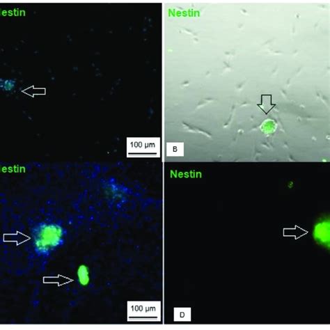 Immunocytochemistry Of Gabaergic Differentiation A Cells Are Showing