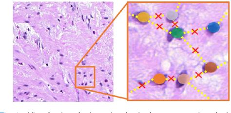Figure 2 From Structure Embedded Nucleus Classification For Histopathology Images Semantic Scholar
