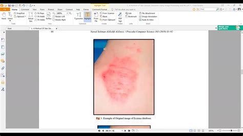 Ii A Method Of Skin Disease Detection Using Image Processing And Ml Youtube