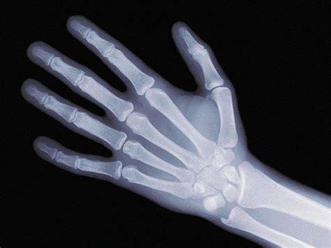 How Does Bone Density Testing Work And What Is It For