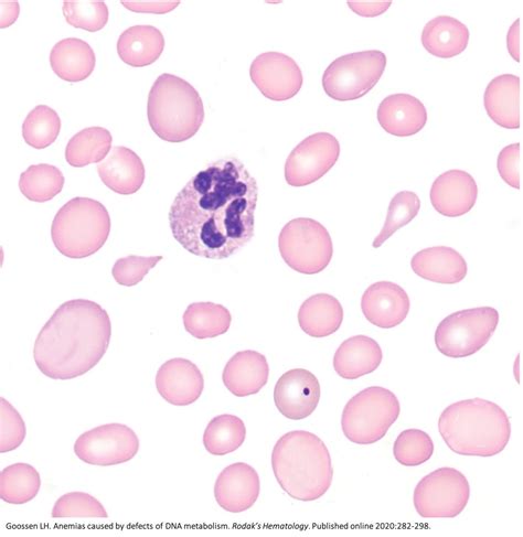 Pathophysio Buzz Chronicles