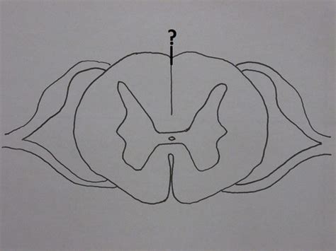 Spinal Cord Lab Quiz Flashcards Quizlet