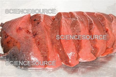 Spleen Post Mortem Gross Specimen Stock Image Science Source Images