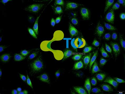 大鼠Ⅱ型肺泡上皮细胞 知乎