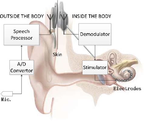 Figure From ASIC FPGA Implementation Of Cochlear Implant CIS Algorithm Based On FFT Filter